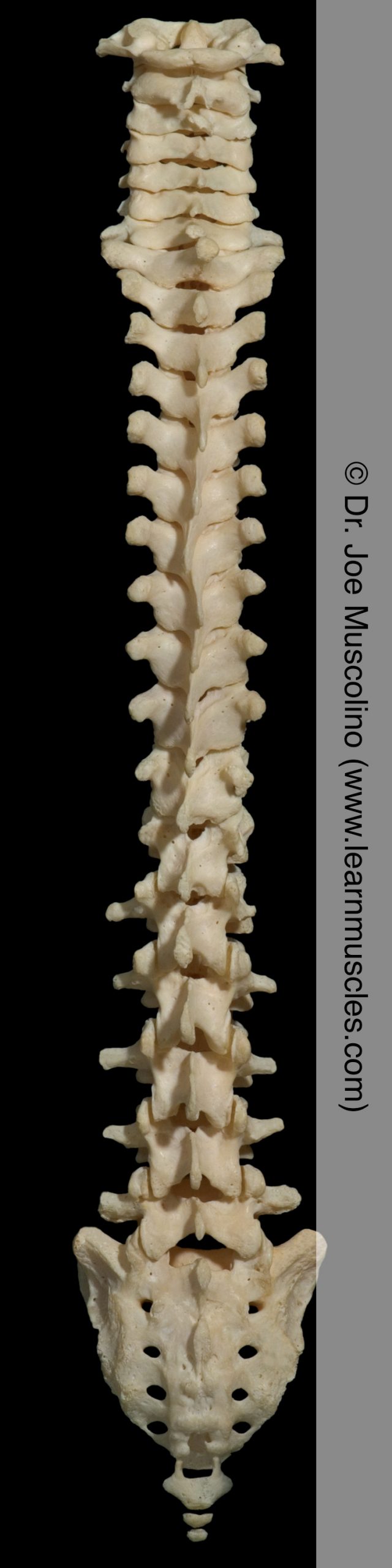Spinal (Vertebral) Joints - Learn Muscles