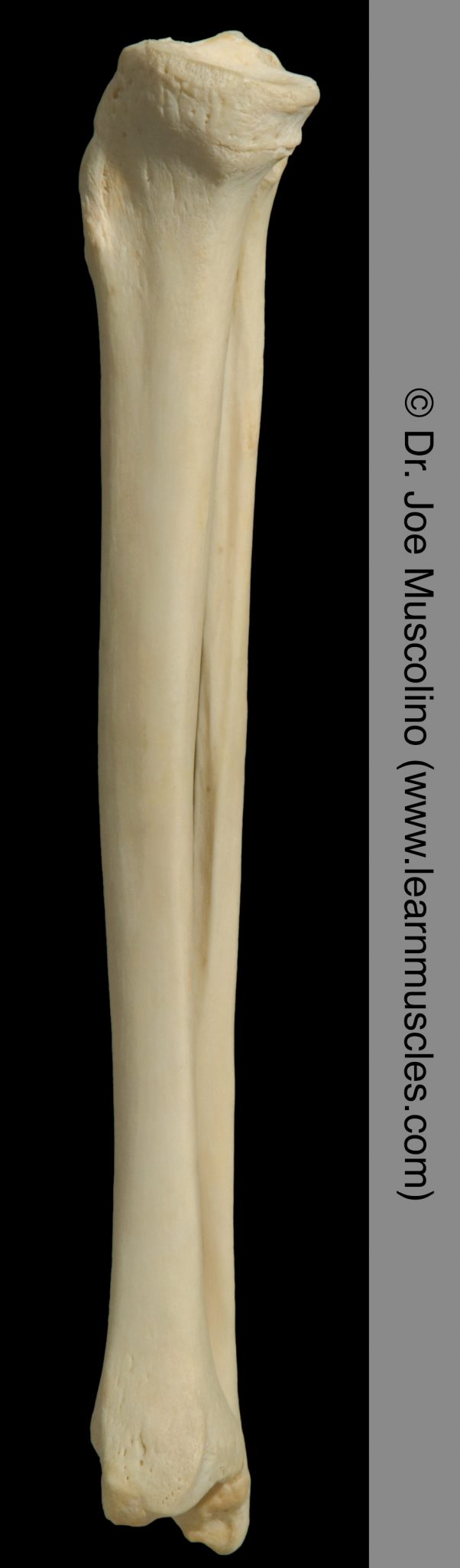 Tibiofibular joint - Learn Muscles