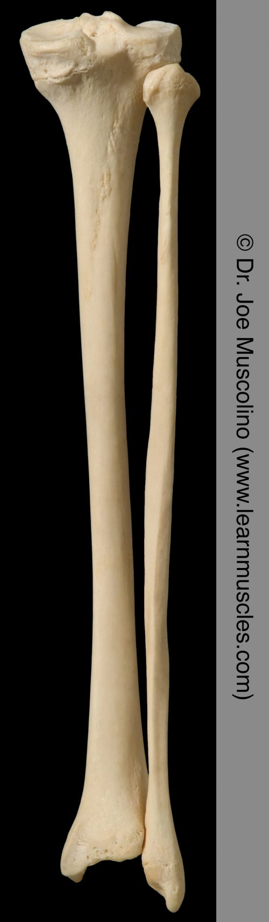 Tibia - Learn Muscles