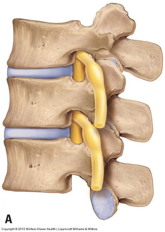 Osteoarthritis (Degenerative Joint Disease) of the Cervical Spine