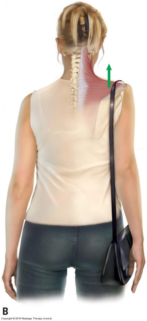 Tension Headaches - Musculoskeletal Condition of the Neck