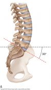 Lower Crossed Syndrome postural distortion pattern