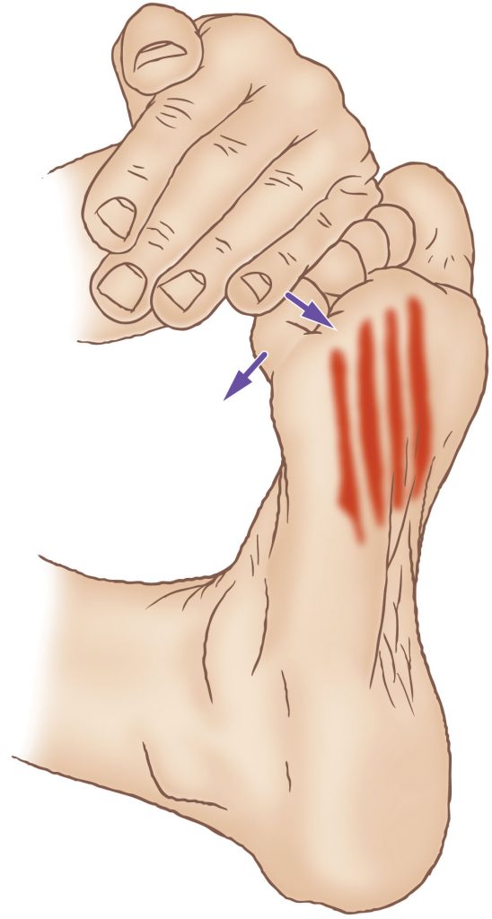 Lumbricals pedis - Stretching - Learn Muscles