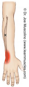 Extensor Carpi Ulnaris - Trigger Points - Learn Muscles