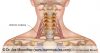 Anterior Scalene - Learn Muscles